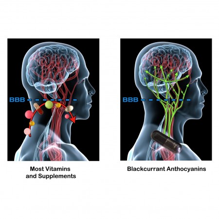 Vision Smart Supreme