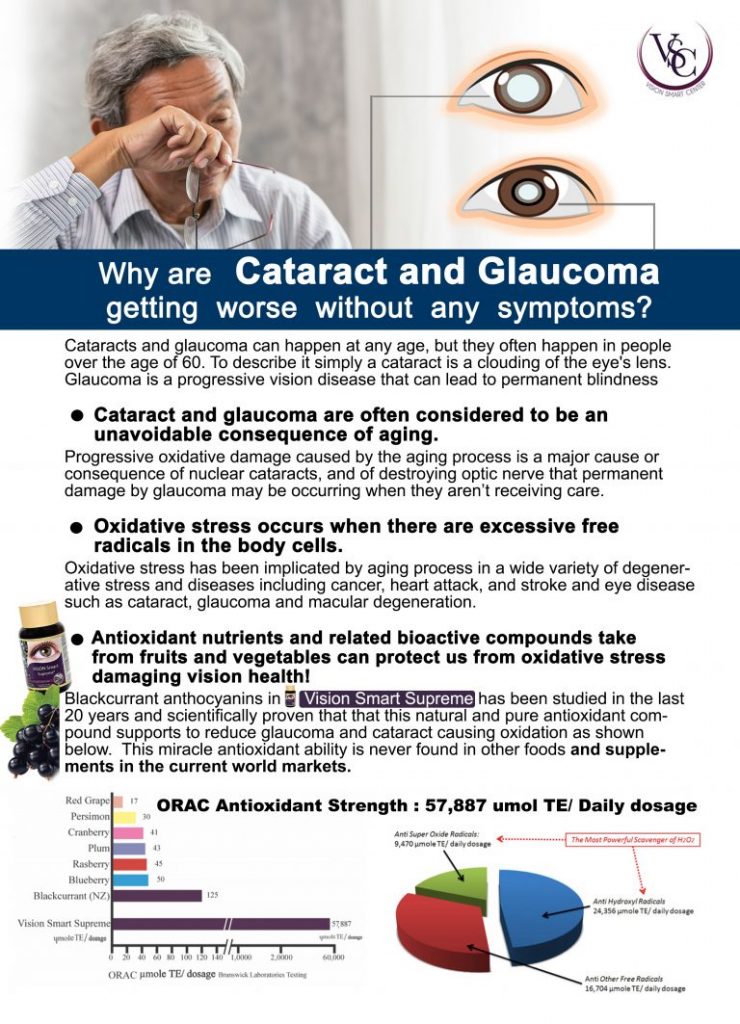 - Vision SmartVision Smart