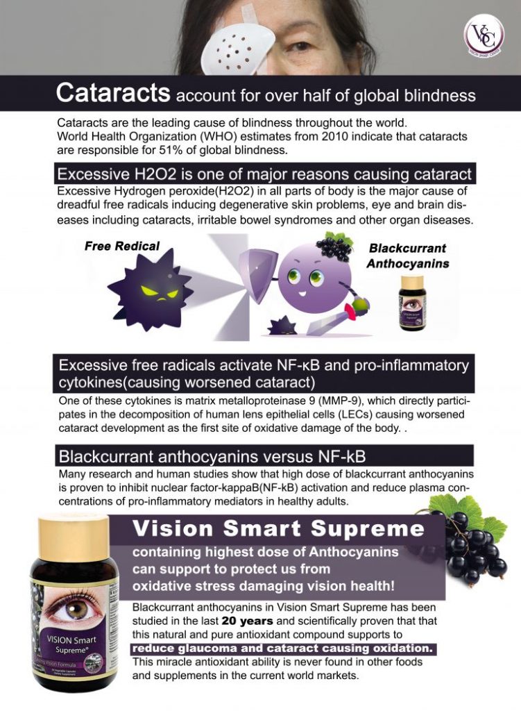 - Vision SmartVision Smart